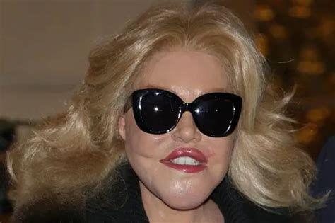 Jocelyn Wildensteins Unrecognisable Looks Before Catwoman Surgeries
