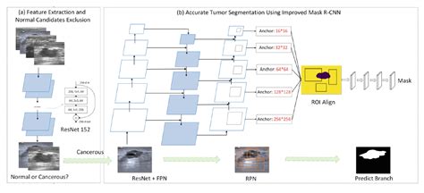 Brief Review — Breast Ultrasound Image Classification And Segmentation Using Convolutional