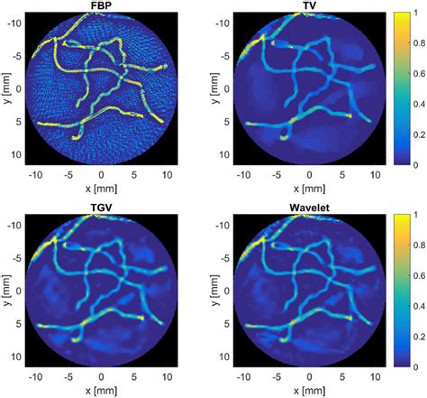 Reconstructions Of The Experimental Phantom In Figure 3 With A Uniform Download Scientific