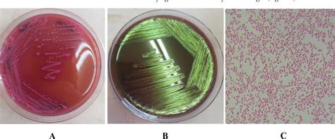 Figure 2 From Isolation And Identification Of Coliform Bacteria And