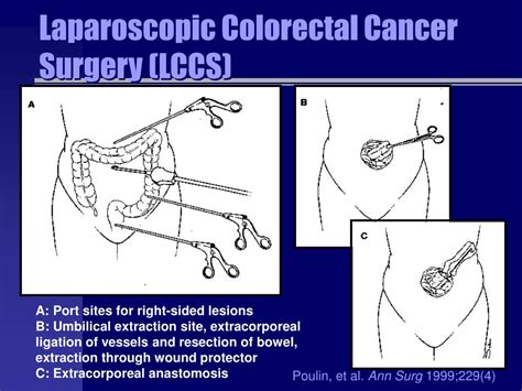 Ppt Laparoscopic Vs Conventional Resections For Colorectal Carcinoma Powerpoint Presentation
