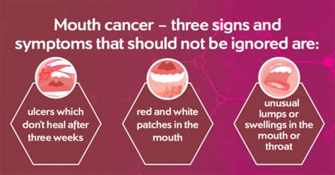 Chris King Mouth Cancer Patient Thamesvalleycanceralliancenhsuk