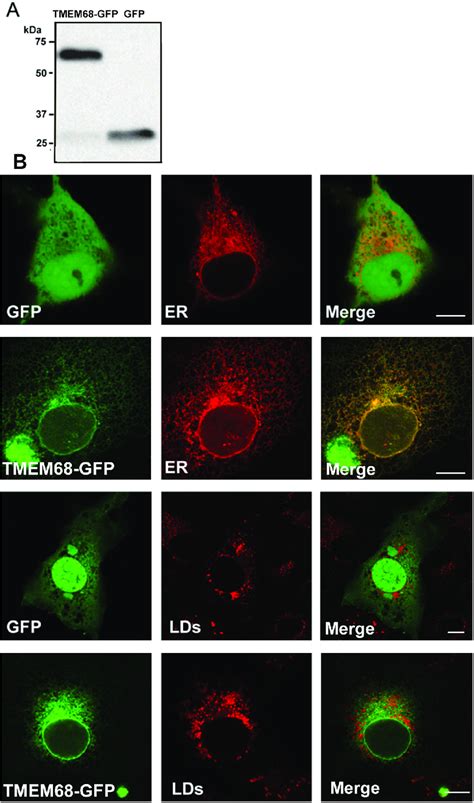 subcellular localization of tmem68 gfp a detection of tmem68 gfp and