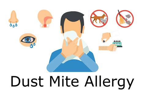 სეზონის ერთ ერთი გავრცელებული ალერგენი მტვრის ტკიპა ჯანმრთელობა Vidal Ge