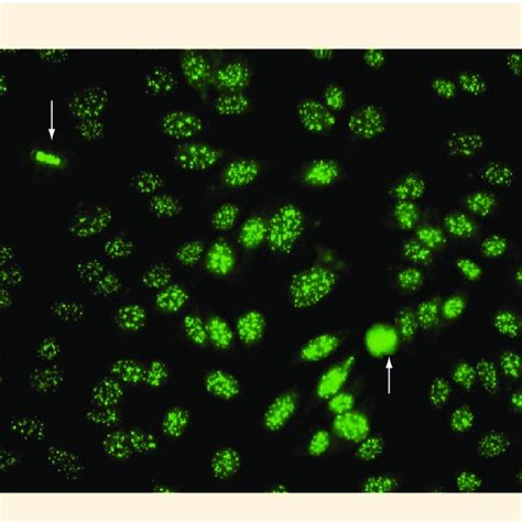 Rimlike Membranous Staining Pattern By Indirect Immunofluorescence On