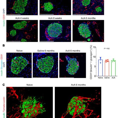 Grading Of Chronic Pancreatitis By Imaging Methods The Cambridge