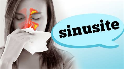 Sinusite ConheÇa Os Sintomas E Tipos Diferentes Youtube