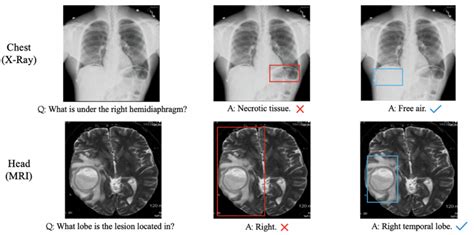 A Brief Survey Of Medical Vqa 知乎