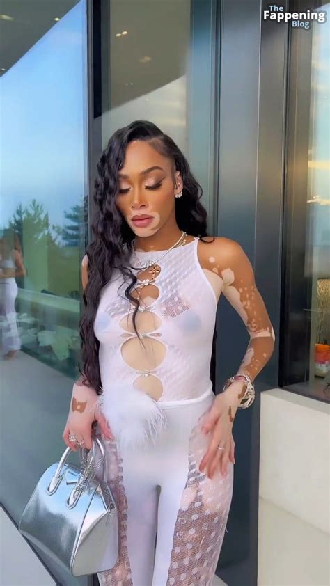 Winnie Harlow Winnieharlow Nude Leaks Photo 1138 TheFappening