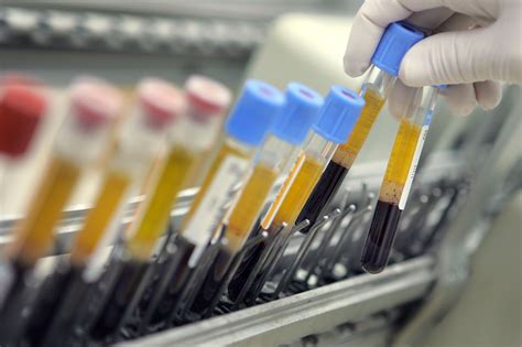 Common Issues With Lab Samples Handling In Clinical Trials Solutions OP