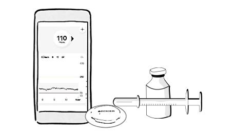 Dexcom G6 Medtronic Pump Vs Dexcom G7 Syringe Unbias Comparison DiabetesWise