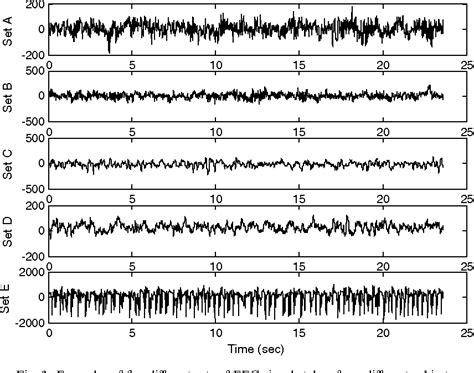Figure 1 From Eeg Signal Classification Using Wavelet Feature