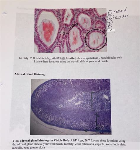 Solved 2 1 Colloid And Falicular 3 14 Identify Colloidal