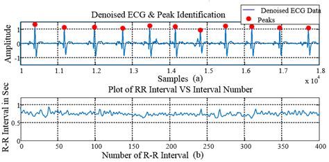 A Peak Identification And B The R R Interval Series Download Scientific Diagram