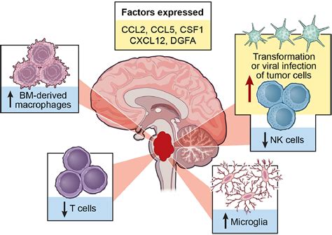 Brain Cancer Cells Diagram