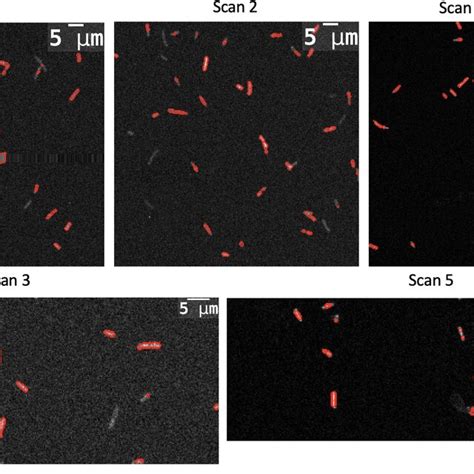 Segmentation Masks Of The Coarse Scans Of Containing Type A And Type B