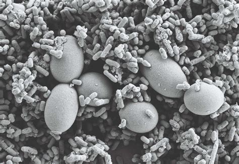 Unique Probiotic Strains — Ab Biotics