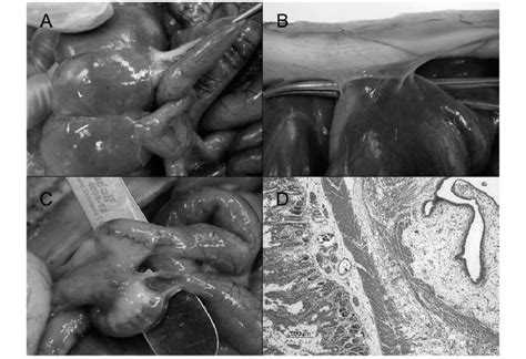 A Grade 2 Adhesion Between The Cecum And Duodenum The Control Group