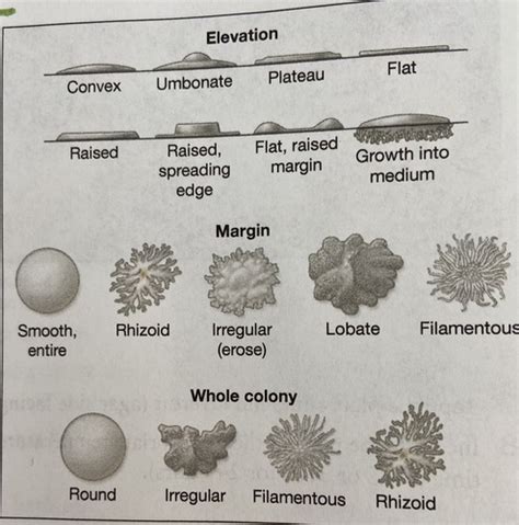 Lab Quiz Flashcards Quizlet