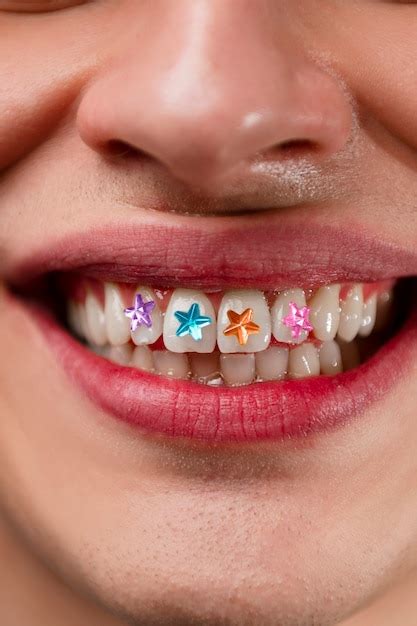 Images De Strass Dentaire Téléchargement Gratuit Sur Freepik