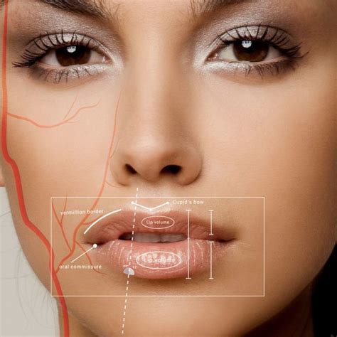 Top BOTOX Injection Patterns Markup SkinViva Training Botox