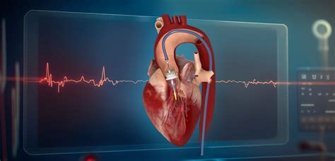 Best Hospital For Percutaneous Aortic Valve Replacement Tavi Valve