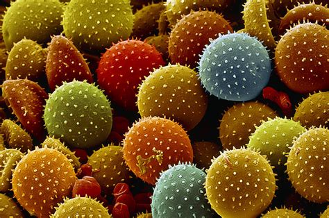 Rust Fungus Spores Sem Photograph By Steve Gschmeissner Fine Art America