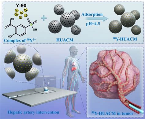 钇[90y]炭微球 成都纽瑞特医疗科技股份有限公司 核能造福社会