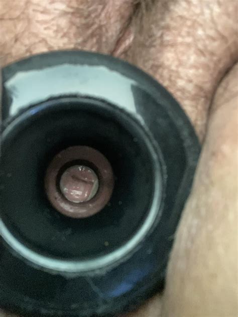 My Favorite Cervix Exposing Toy Rcervix