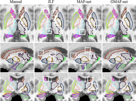 Visualization Of Segmentation Results Of One Representative Image From