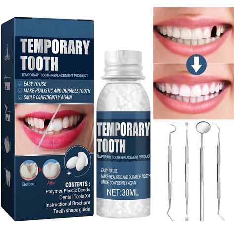 Tooth Repair Kit Fixing The Missing And Broken Tooth Replacements Temporary Teeth