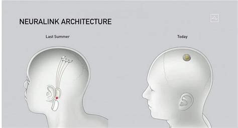 my article on brain chips in human rukhiya masthani shaik posted on the topic linkedin