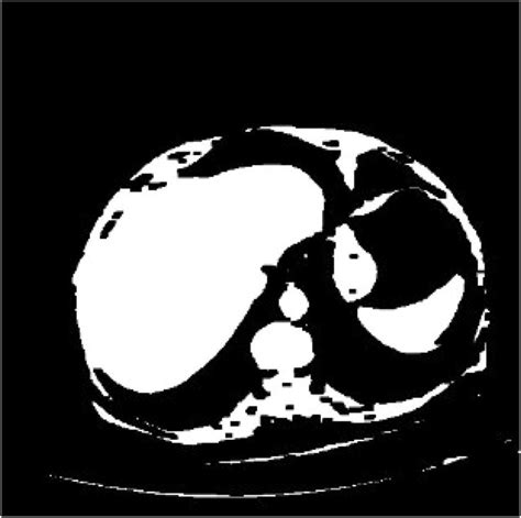 Hog Feature Extraction Operation In Second Phased Based On Edge And Download Scientific Diagram
