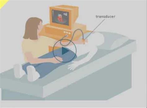 Cardiac Output Using Echocardiogram At Best Price In Chennai