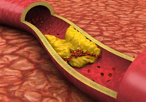 Mens Sexual Health After 40 Common Concerns And Solutions