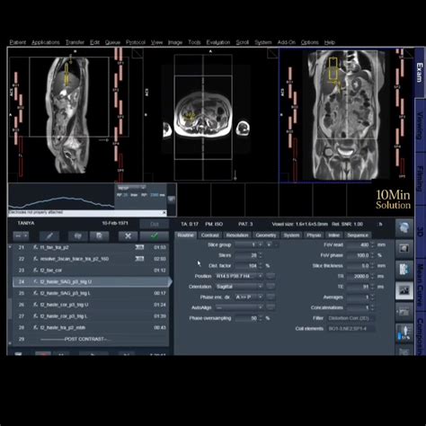 How To Mri Of Whole Abdomen Planning And Protocol Step By Step Guide