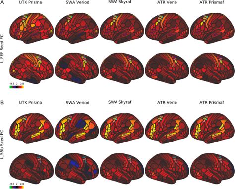 Seed Based Resting State Functional Connectivity In A Single Traveling Download Scientific
