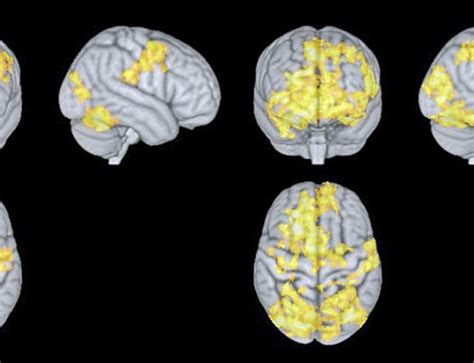 The Brains Default Mode Network What Does It Mean To Us The Meditation Blog