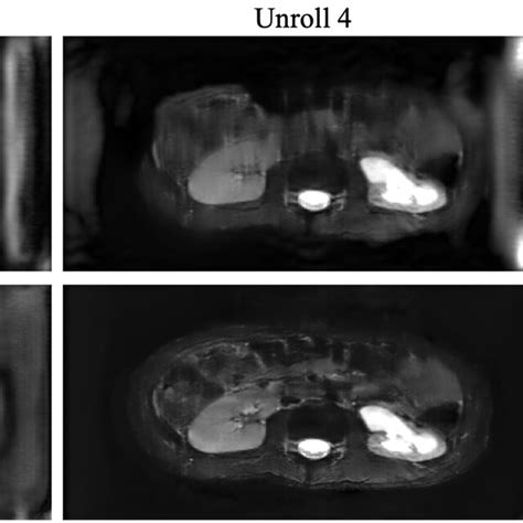 structural similarity index measure ssim comparison between baseline