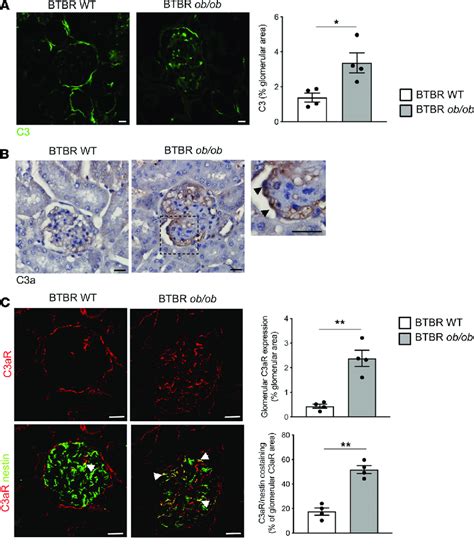 Glomerular Complement Activation In Mice With Type 2 Dn Representative Download Scientific