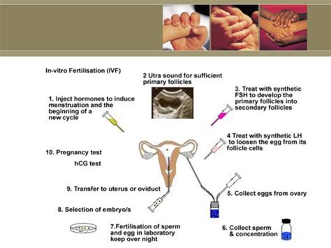 Assisted Reproductive Technologies