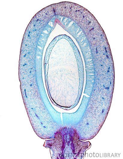 Bean Pod As Seen Through A Microscope Microscopic Photography Micro