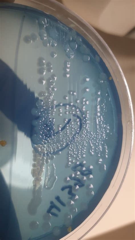 Proteus Mirabilis Introduction Morphology Pathogenicity Lab Diagnosis