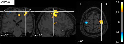 nilearn statistical analysis for neuroimaging in python — machine