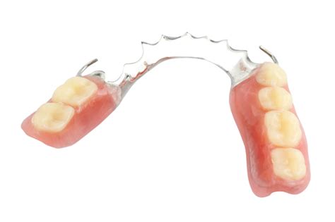 Partial Dentures For Back Teeth