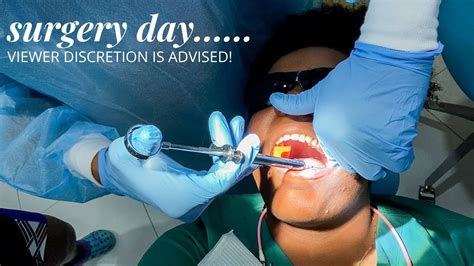 I Did A Surgery Operculectomy Vlog Youtube