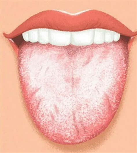 Health And Beauty Glossitis