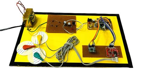 Iot Based Health Monitoring With Ecg Spo2 And Temperature Sr Robotics