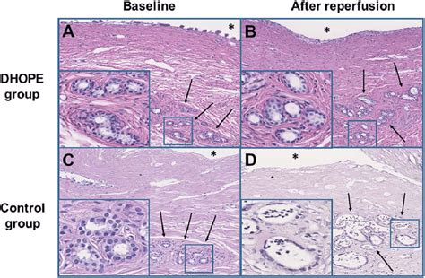 Common Bile Duct Histology