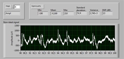 visualization of eeg signal with spike detection and modification of
